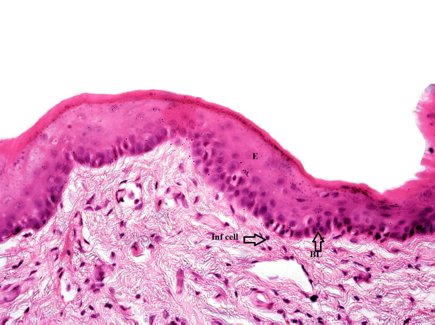 : HISTOLOGICAL EFFECT OF METHOTREXATE AND FOLINIC ACID ON ORAL ...