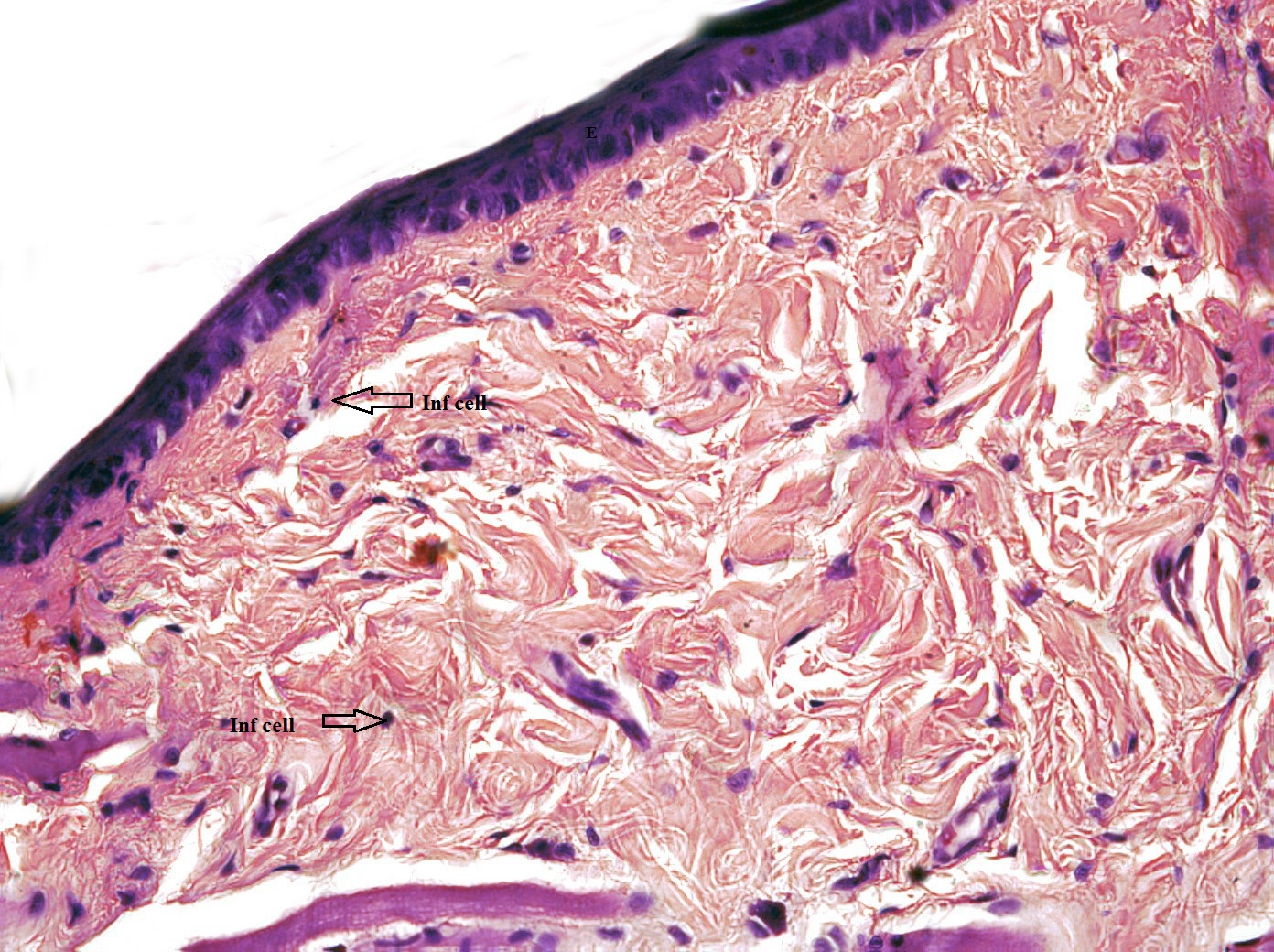: HISTOLOGICAL EFFECT OF METHOTREXATE AND FOLINIC ACID ON ORAL ...