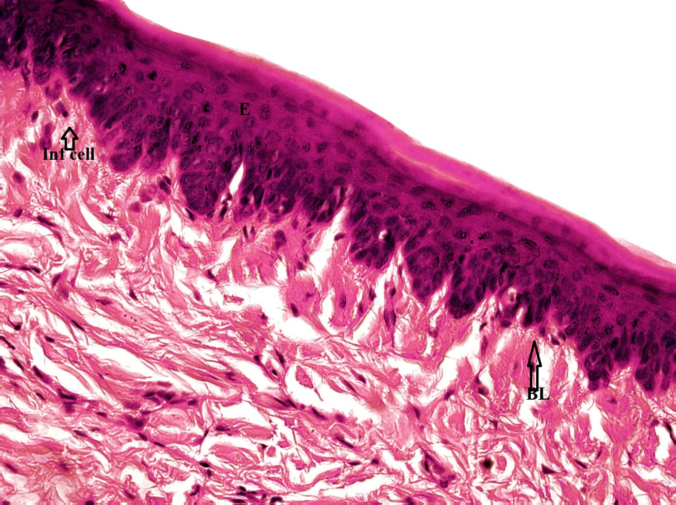 : HISTOLOGICAL EFFECT OF METHOTREXATE AND FOLINIC ACID ON ORAL ...