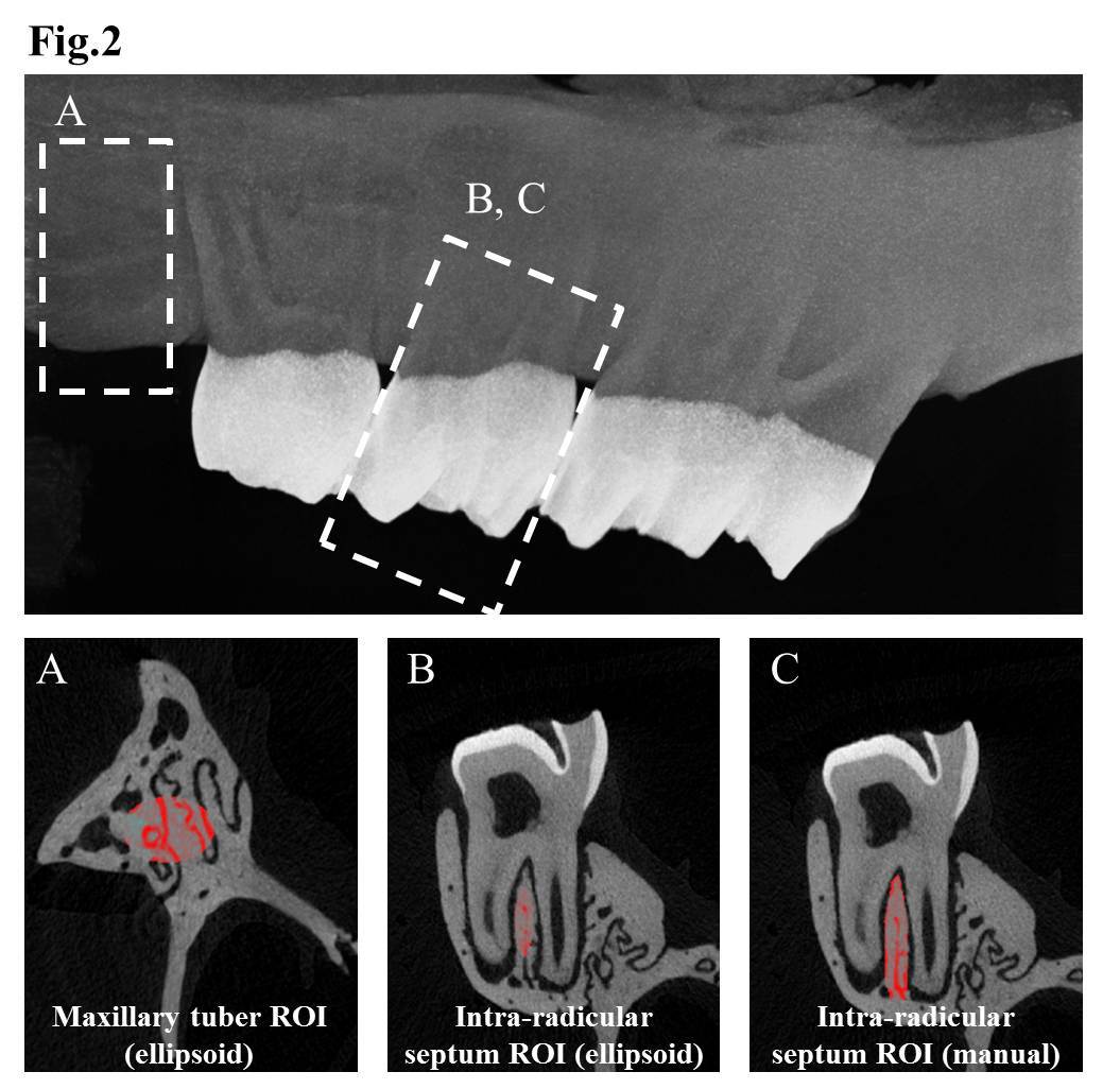 Methodology for Assessment of the Rat Jaw Bone Microstructure Using Ex ...