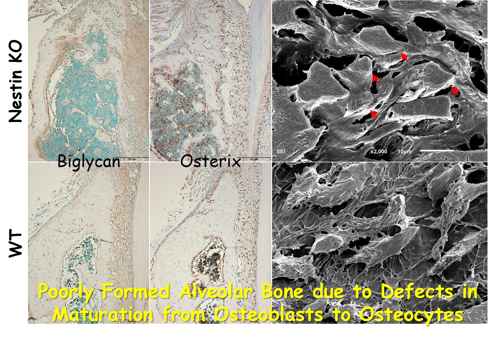 Novel Roles of Nestin in Bone, Cementum and Root Dentin IADR Abstract Archives