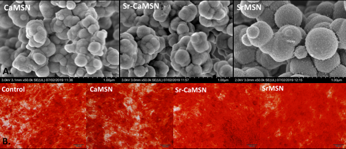 Strontium-modified peptide-loaded silicate nanoparticles for enhanced ...