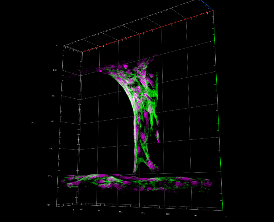 3D-printed Biodegradable Piezoelectric Scaffold for Bone Regeneration ...