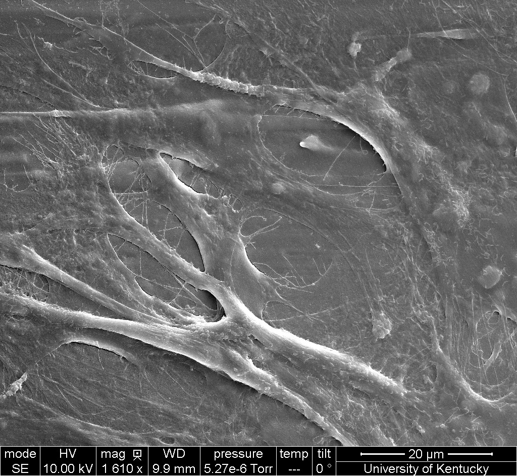 3D-printed Biodegradable Piezoelectric Scaffold for Bone Regeneration ...